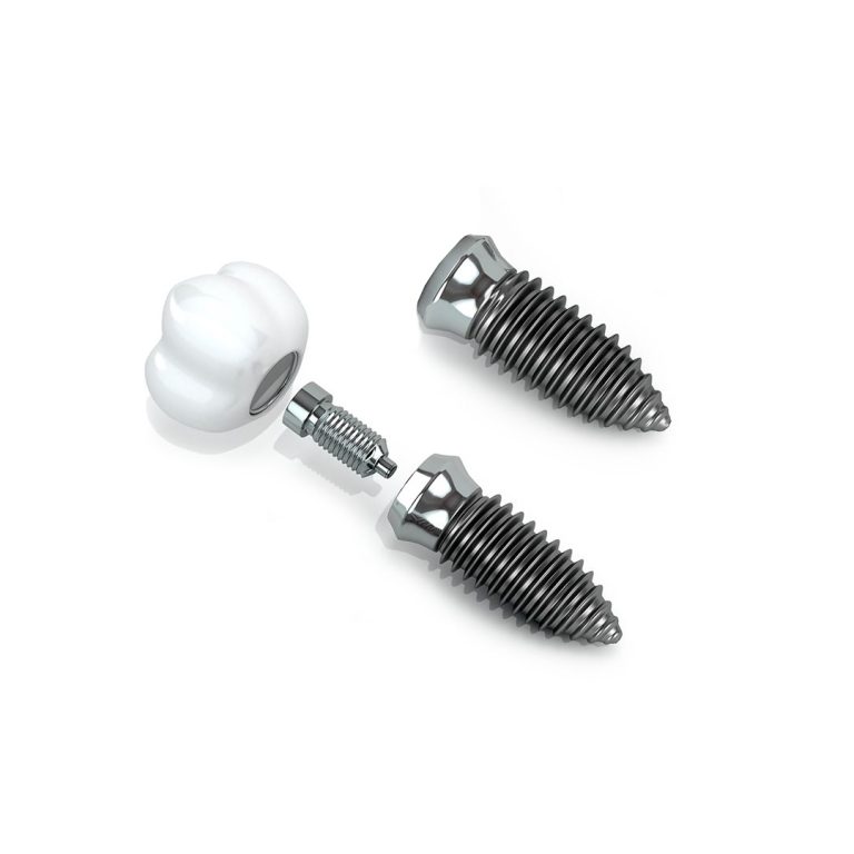 DENTURA Dental Implants - INVAMED